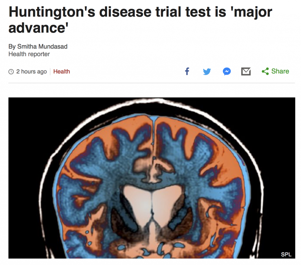 BBC News – Huntington’s disease trial test is ‘major advance ...